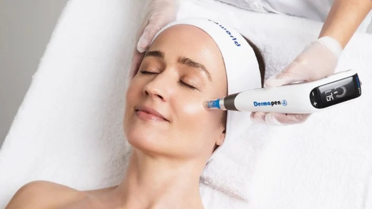 Micro-Needling – monalisalaserclinic.co.nz